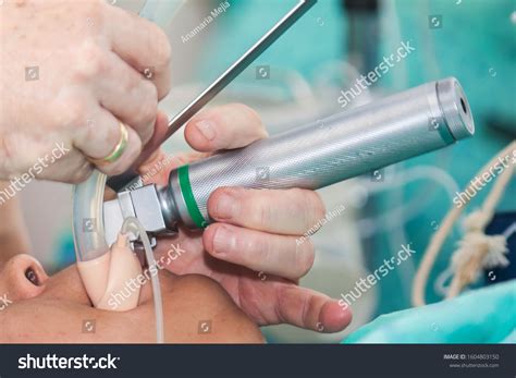 Image result for Surgery Intubation