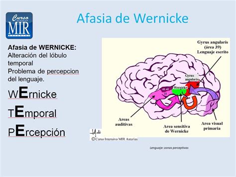 Image result for The Function of the Wernicke Connection