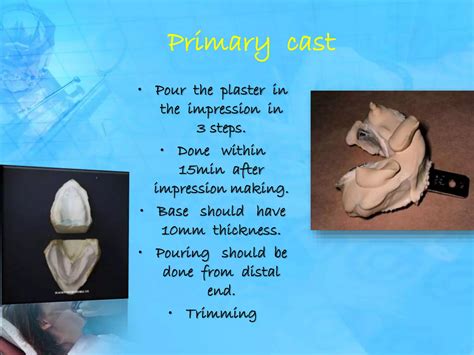 Image result for How to Process a Denture