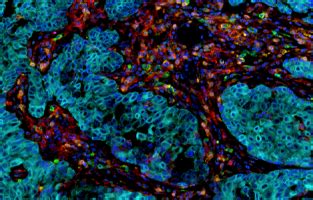 Image result for Multiplex IHC Texture Types Diffuse