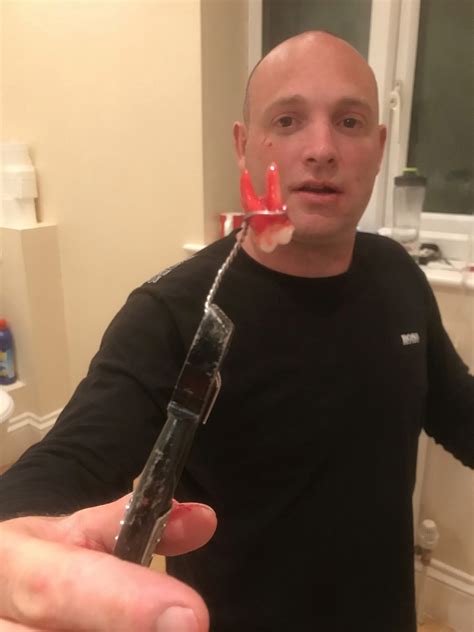 Image result for Tooth Out Pull Fail