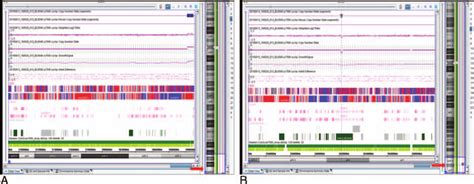Image result for Duplication Chromosome Microarray