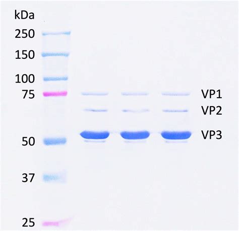 Image result for AAV Vector Purification Kit
