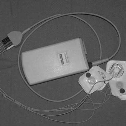 Image result for External Loop Recorder