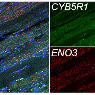 Image result for Tissue Microarray Multiplex IHC NCR