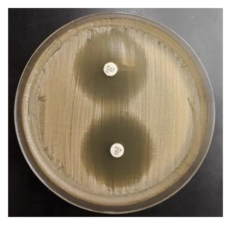 Image result for Disadvantages of Using Disk Diffusion Method