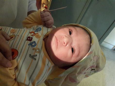 Image result for Red Reflex