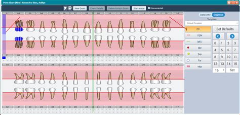 Image result for How to Read a Perio Chart