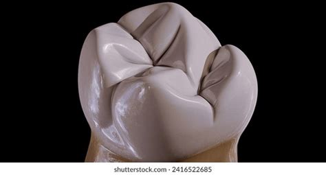 Image result for Maxillary First Molar