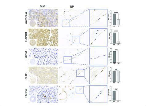 Image result for Tissue Microarray Multiplex IHC NCR