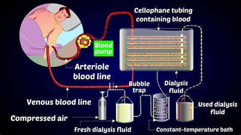 Image result for How Does a Dialysis Machine Work