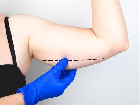 Image result for Body Contouring Surgery