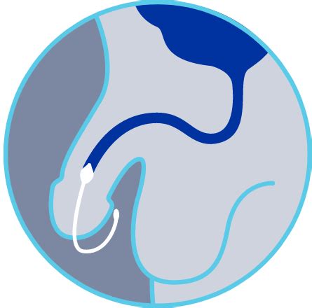 Image result for How to Use Contino Device