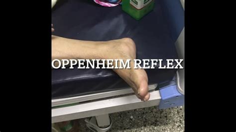 Image result for Chaddock Reflex Video