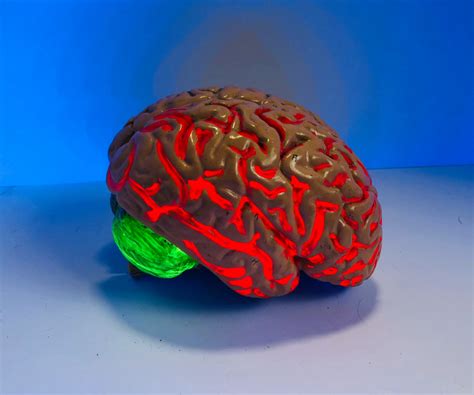 Image result for Extrapyramidal Rigidity Icon