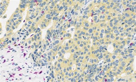 Image result for Multiplex IHC