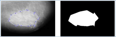 Image result for Manual Extraction