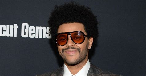 Image result for The Weeknd Botox