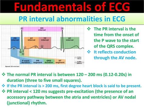 Image result for Normal PR Interval Fetus