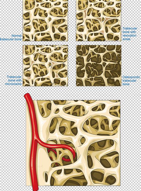 Image result for Trabecular Bone Structure