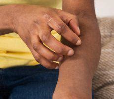 Image result for Threading Rash