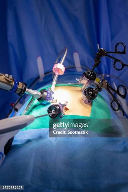 Image result for Endoscopy Operating Room