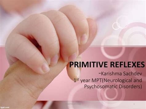 Image result for Neonatal Primitive Reflexes