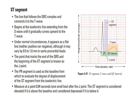 Image result for ECG Step by Step