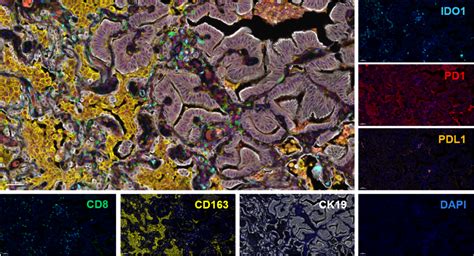 Image result for Multiplex IHC