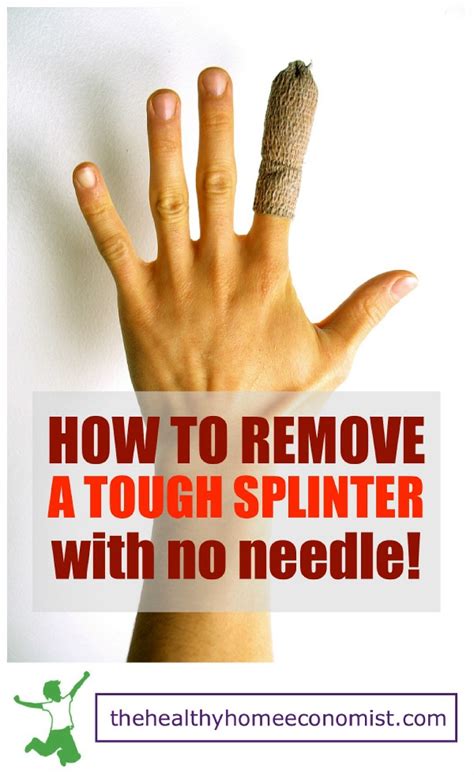 Image result for Drawing Ointment to Remove Splinter