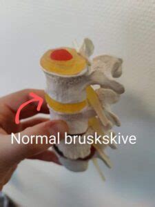 Image result for Discus Block Leg