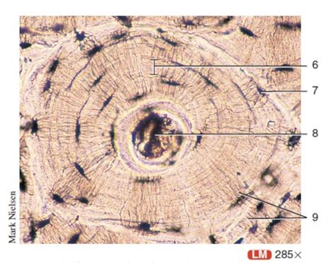Image result for Compact Bone Cross Section