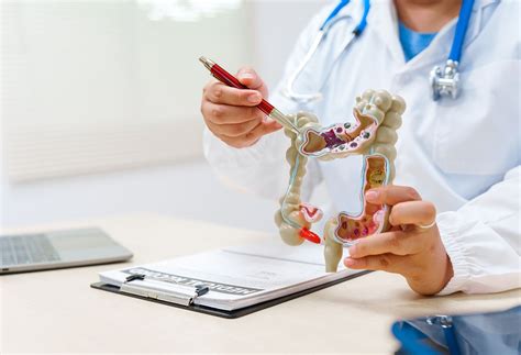 Image result for Colonoscopy Frequency Hyperpplastic Polyp