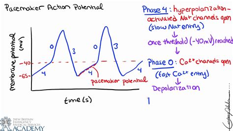 Image result for Pacemaker Potential