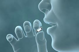 Image result for Endoscopy Small Intestine