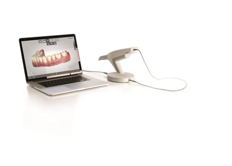 Image result for Trios Scanner