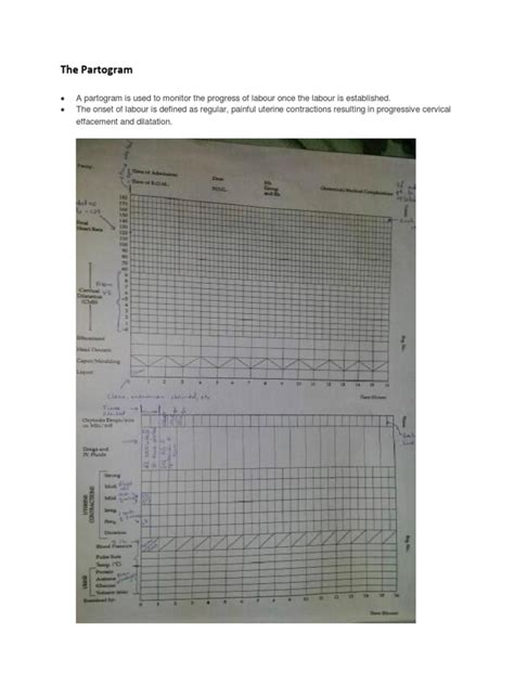 Image result for How to Fill the Partogram