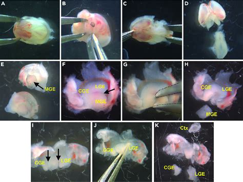 Image result for Mice Brain Dissection