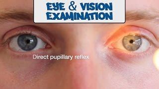 Image result for Visual Field Testing OSCE AMC