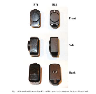 Image result for How to Perform Bone Conduction Testing