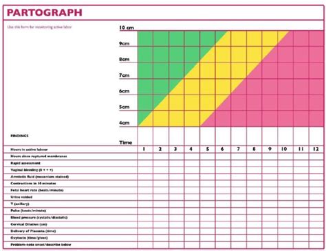 Image result for Types of Partograph
