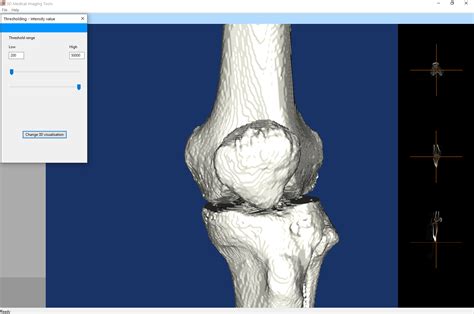 Image result for 3D Scan Medical