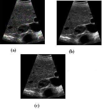 Image result for Homomorphic filtering Applications