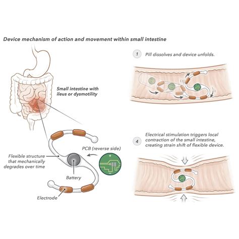 Image result for Alar Guide