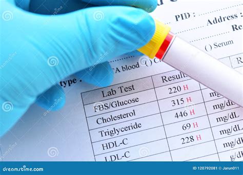 Image result for Lipid Profile Testing