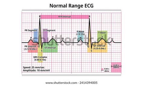 Image result for PR Interval ECG Boxes