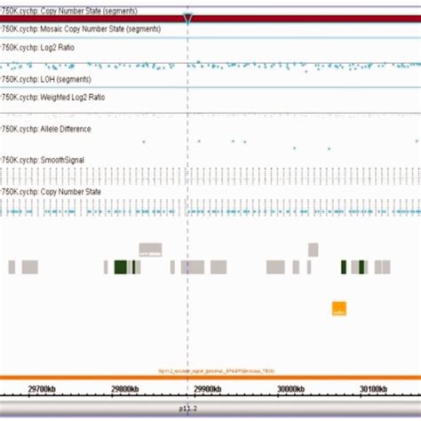 Image result for Chromosomal Microarray Procedure