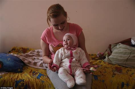 Image result for Birth Defects From Chernobyl Disaster