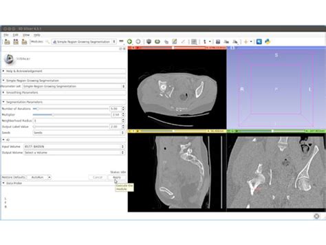 Image result for 3D Scan Medical