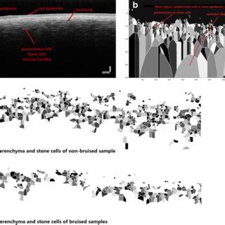 Image result for Oct Axial Resolution